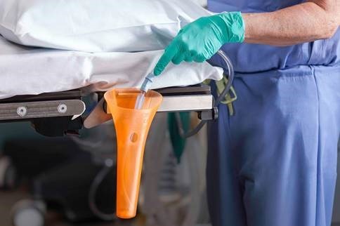 SuctionShield Holster | When you need suction now!