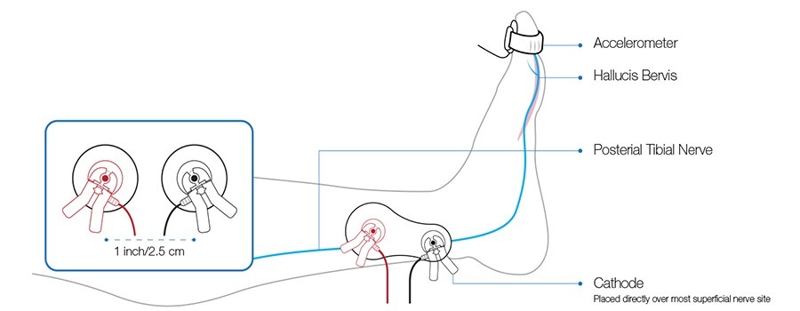 New Stimpod 450X+ Nerve Stimulator & TOF Monitor - Free Demo!
